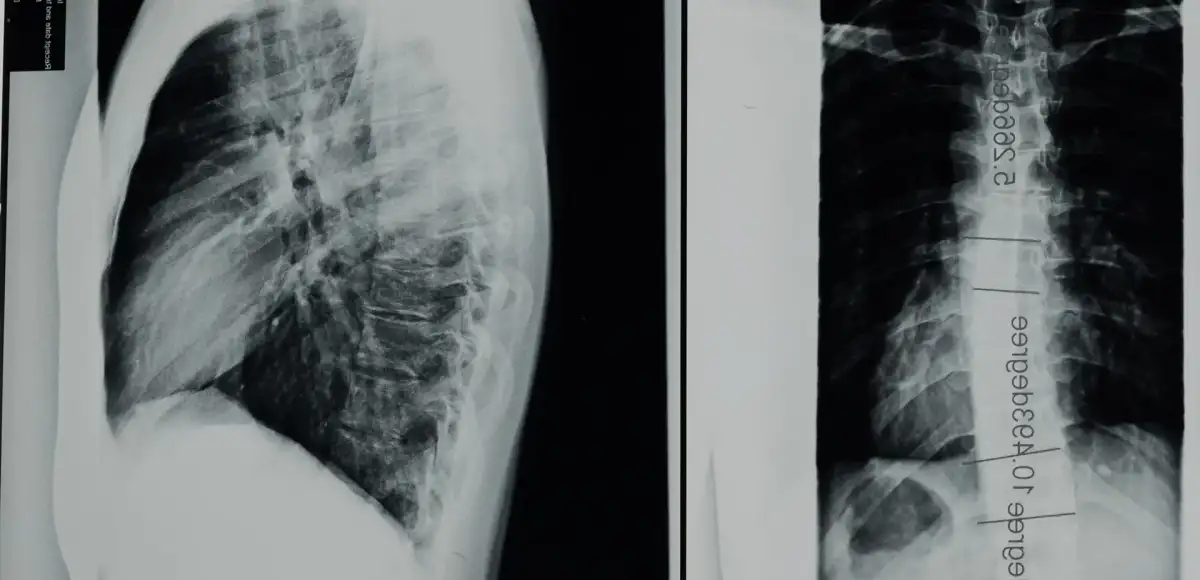 Mklabs | Medical Robots: Ultrasound’s Rising Role in Medical Imaging Mklabs | Medical Robots: Ultrasound’s Rising Role in Medical Imaging